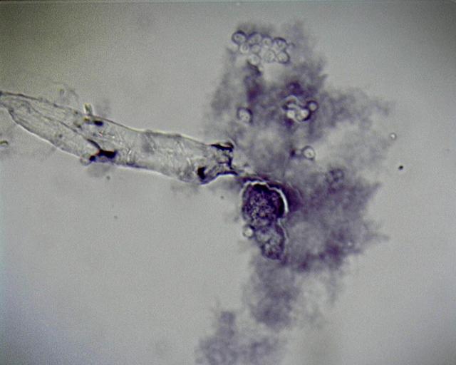 Philip Harris Prepared Microscope Slide - Amoeba proteus W.M ...