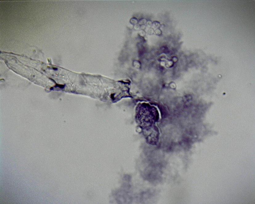 Philip Harris Prepared Microscope Slide - Amoeba proteus W.M ...