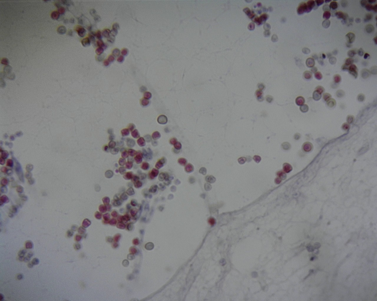 Penicillium Microscope Penicillium Italicum P. Roqueforti Fungi