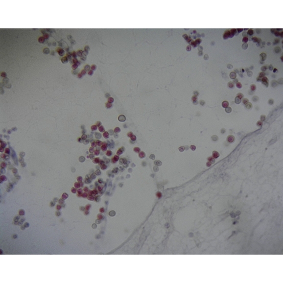 Penicillium Microscope Penicillium Italicum P. Roqueforti Fungi