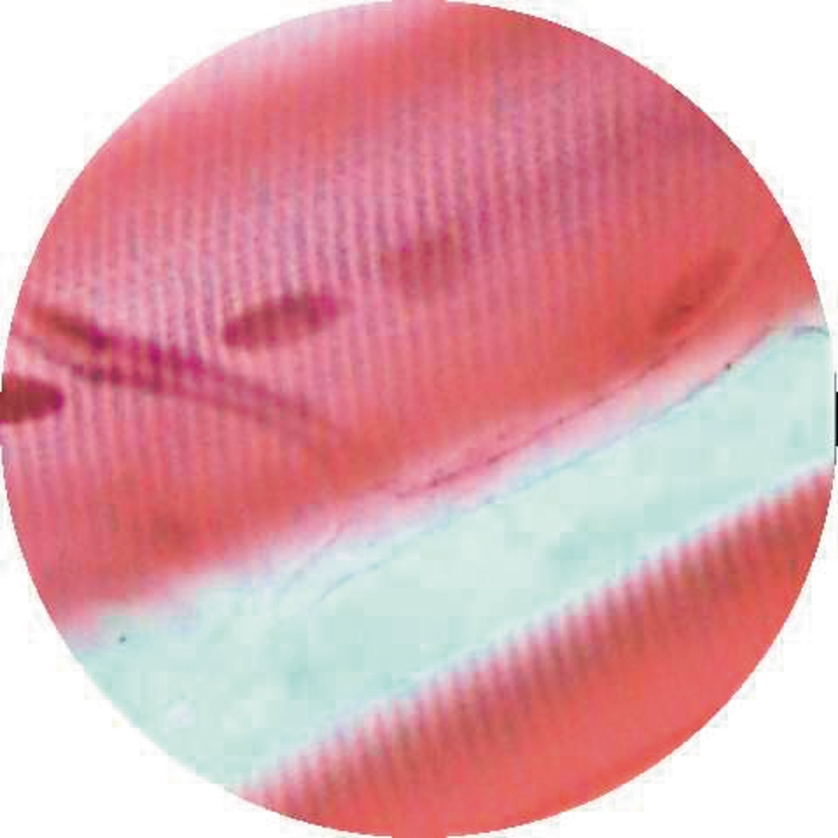 Prepared Microscope Slide - Striated Muscle: for Muscle Spindles T.S ...