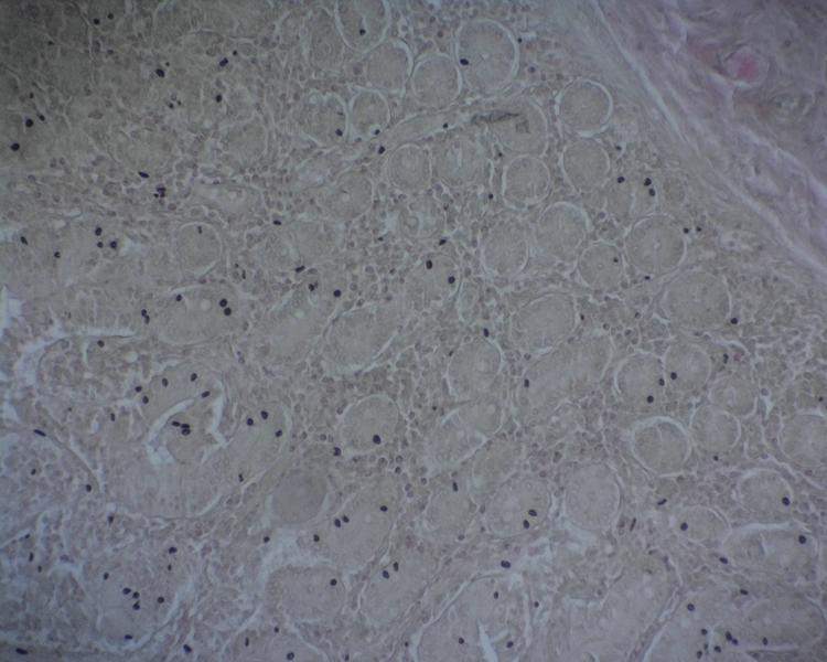 Philip Harris Prepared Microscope Slide - Non-striated (Smooth) Muscle ...