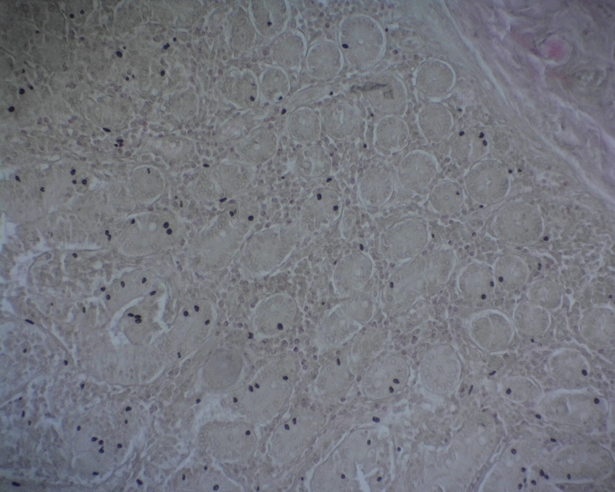 Philip Harris Prepared Microscope Slide - Non-striated (Smooth) Muscle ...