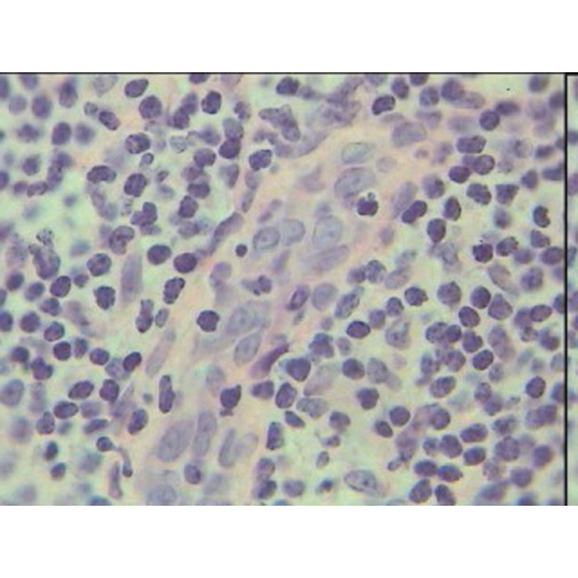 Lymph Node Microscope Slide 0032