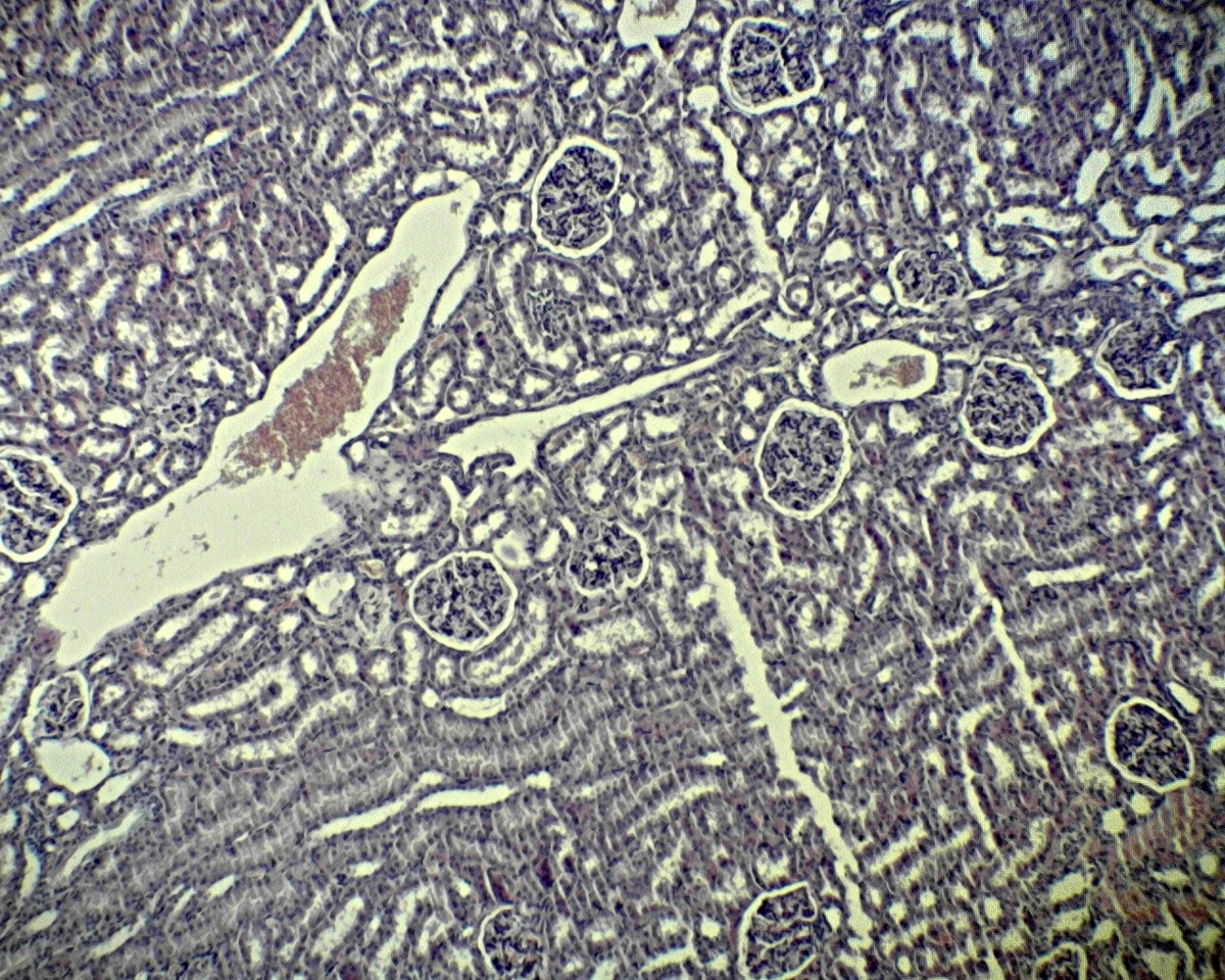 Philip Harris Prepared Microscope Slide - Kidney Thin Section V.S ...