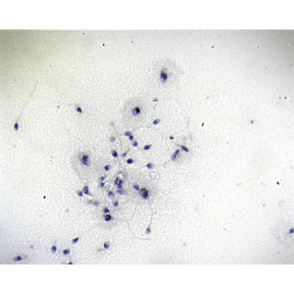 Spinal Cord Smear Slide