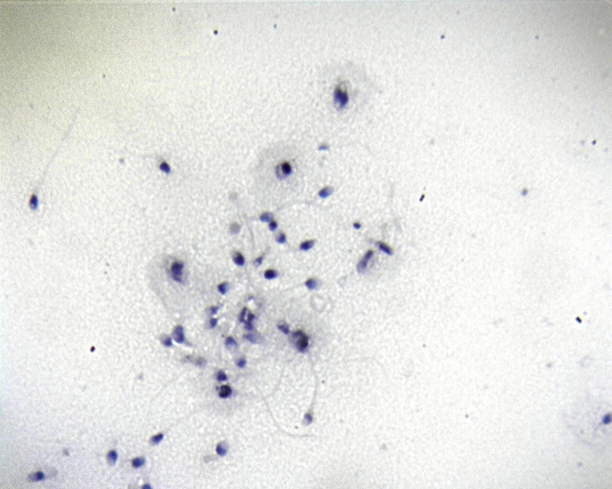 Philip Harris Prepared Microscope Slide - Human Spermatozoa Smear ...