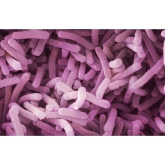 Lactobacillus Casei Shirota From By Product To Functional Food: The