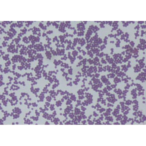 Staphylococcus Epidermidis Staphylococcus Epidermidis Microbiology