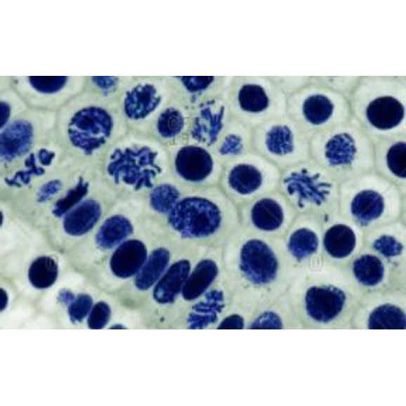 Meiosis Prophase 1 Microscope