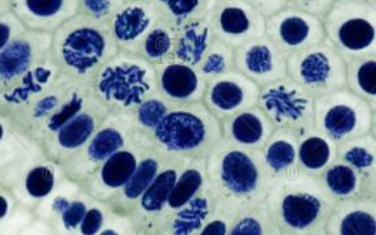 Philip Harris Prepared Microscope Slide Set - Mitosis and Meiosis - Set ...